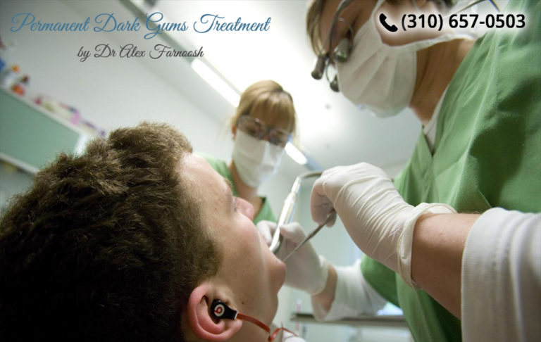 Treatment And The Gummy Smile Cost In Los Angeles Dark Gum Treatment treatment-and-the-gummy-smile-cost-in-los-angeles-dark-gum-treatment